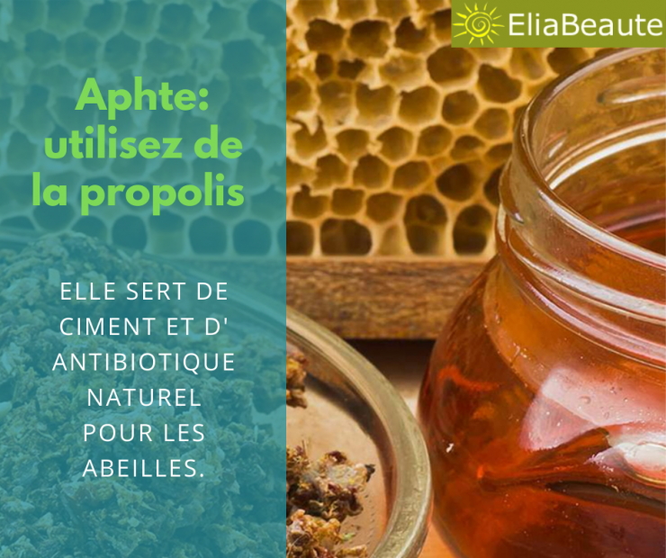 Aphte : qu'est-ce que c'est et comment le soigner